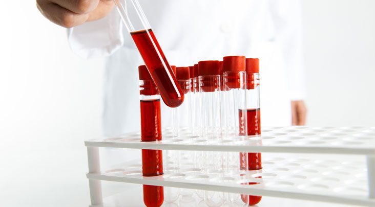 حقن جليكوفوس لعلاج انخفاض مستوى الفوسفات في الدم Glycophos – روشتة