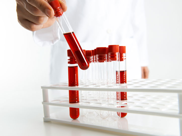 حقن جليكوفوس لعلاج انخفاض مستوى الفوسفات في الدم Glycophos – روشتة للدواء